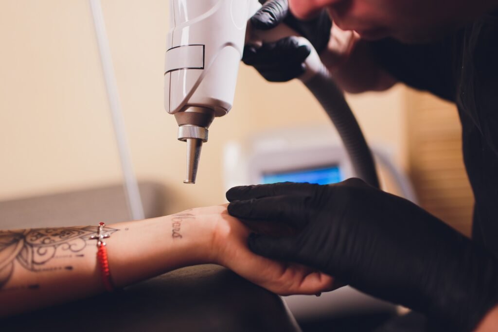 Pourquoi choisir le détatouage par laser ? - Prendre soin de sa peau