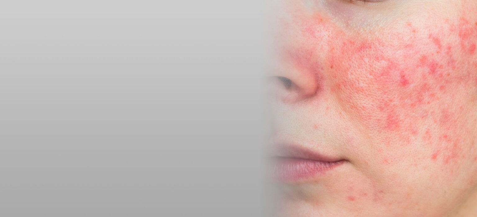 Top 5 des problèmes de peau les plus courants et comment la science ...
